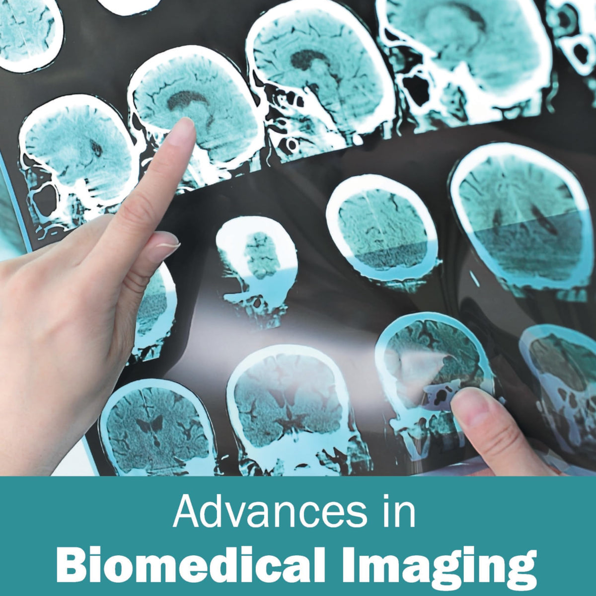 Advances in Biomedical Imaging | Retail Maharaj