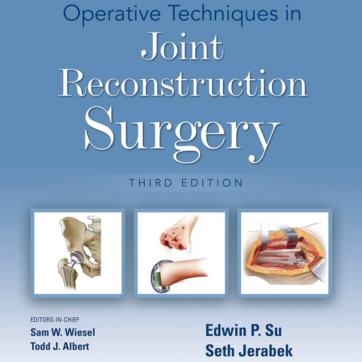 Operative Techniques in Joint Reconstruction Surgery