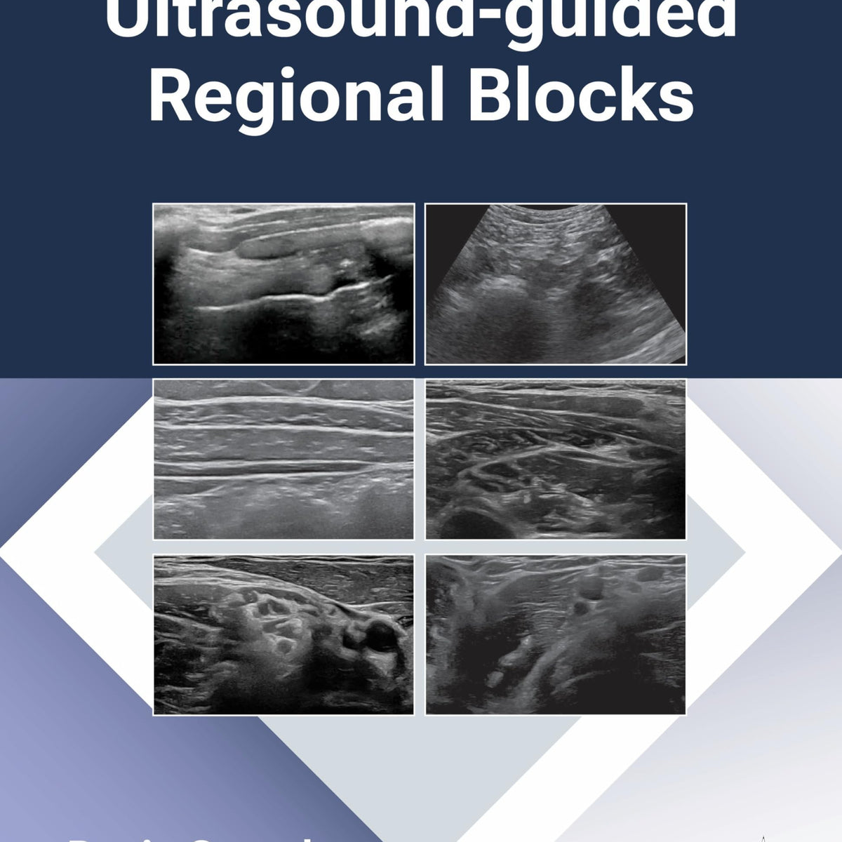 Ultrasound-Guided Regional Blocks