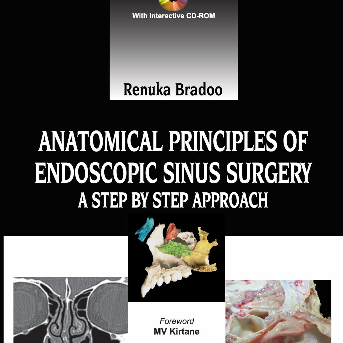 ANATOMICAL PRINCIPLES OF ENDOSCOPIC SINUS SURGERY: A STEP BY STEP APPR