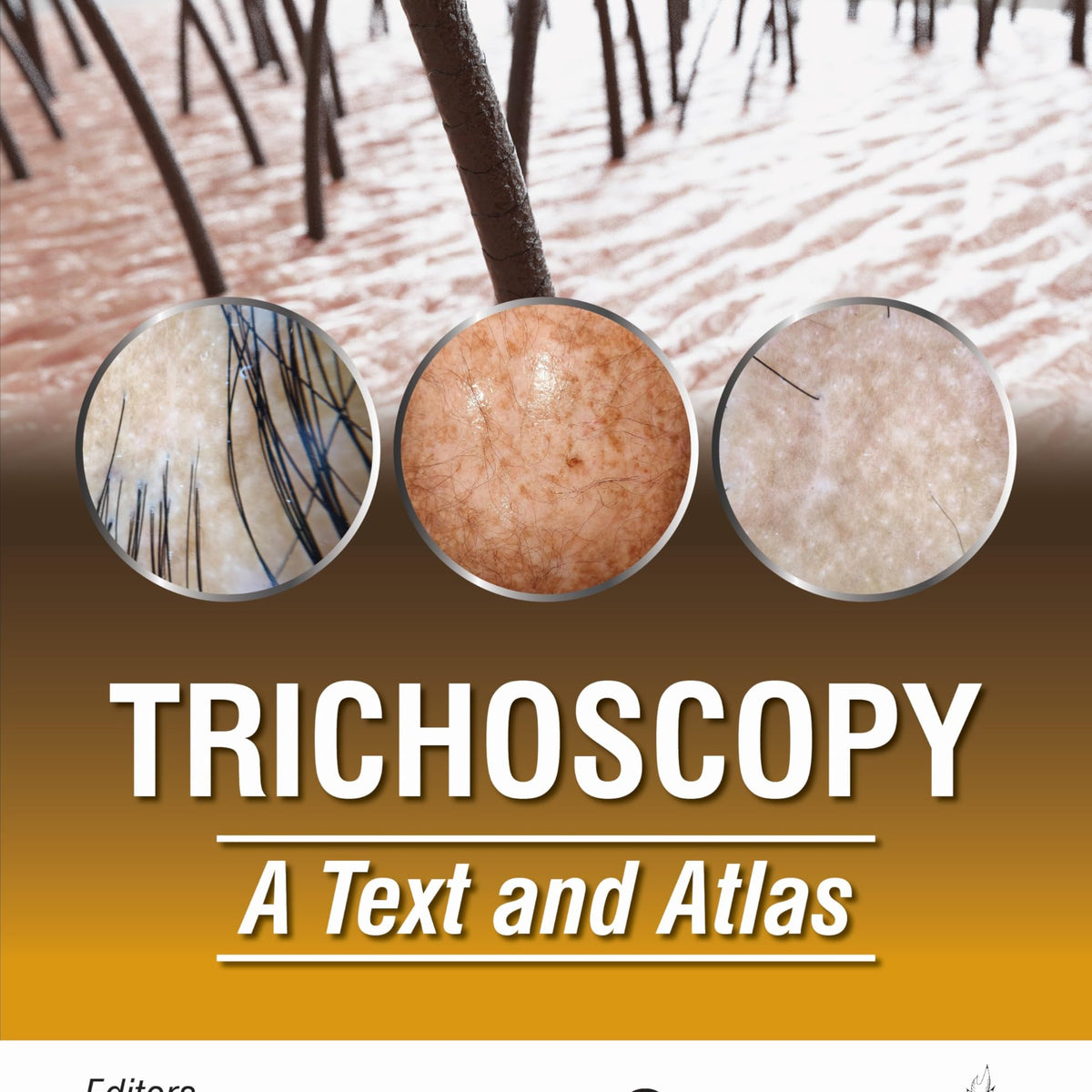 TRICHOSCOPY A TEXT AND ATLAS