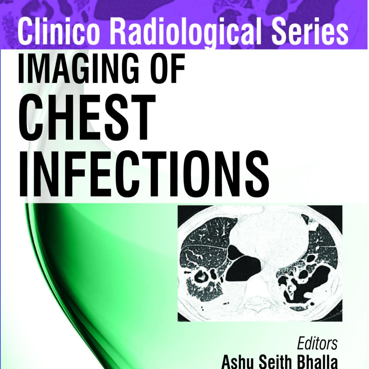 Clinico Radiological Series: Imaging of Chest Infections