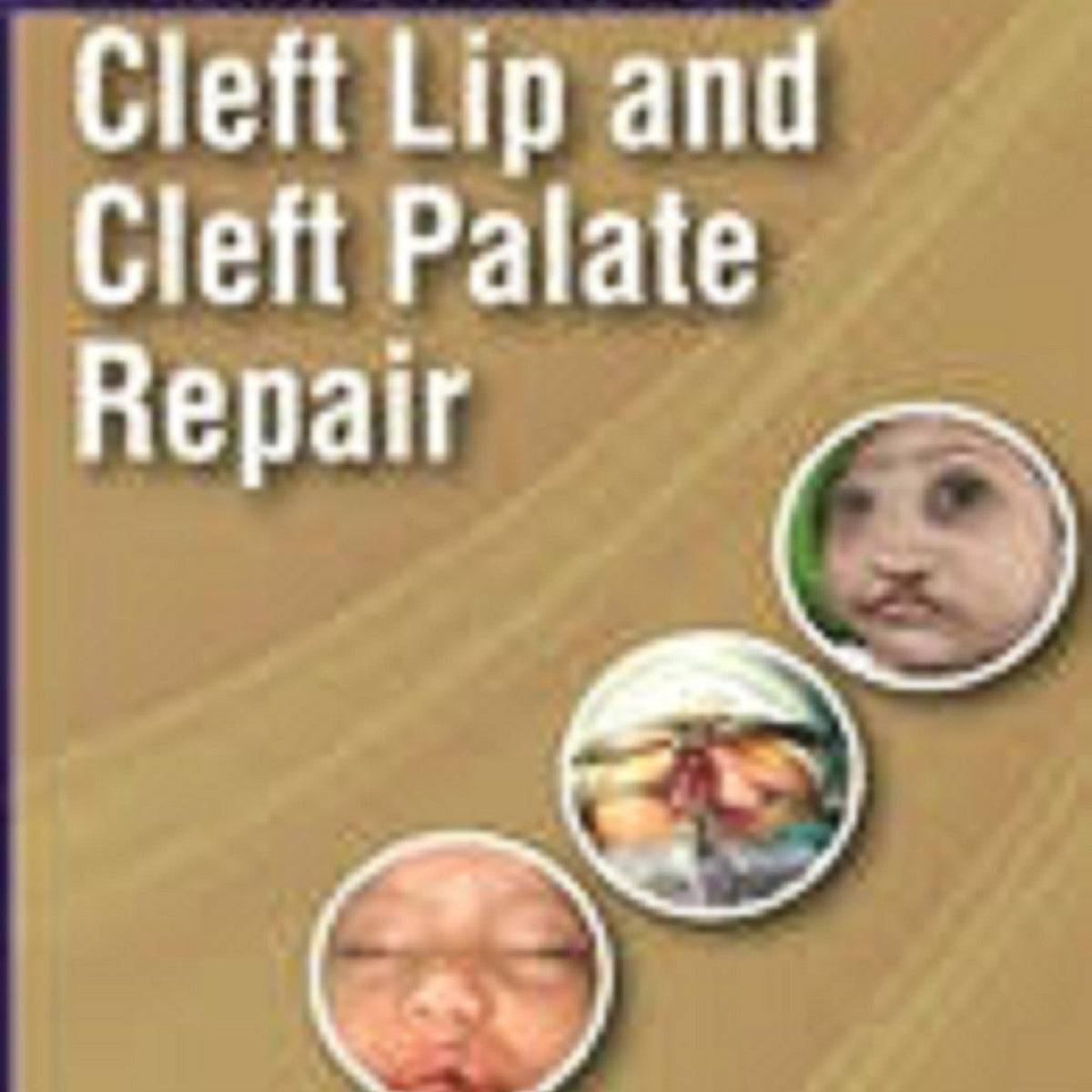 ART AND SCIENCE OF CLEFT LIP AND CLEFT PALATE REPAIR
