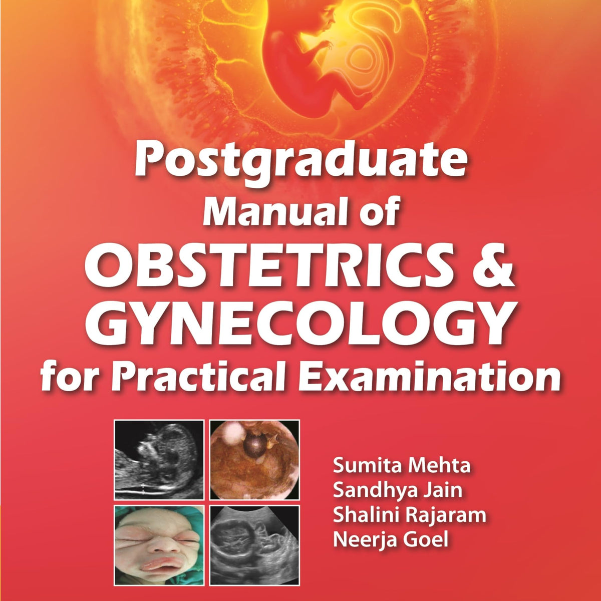 POSTGRADUATE MANUAL OF OBSTETRICS & GYNECOLOGY FOR PRACTICAL EXAMINATI