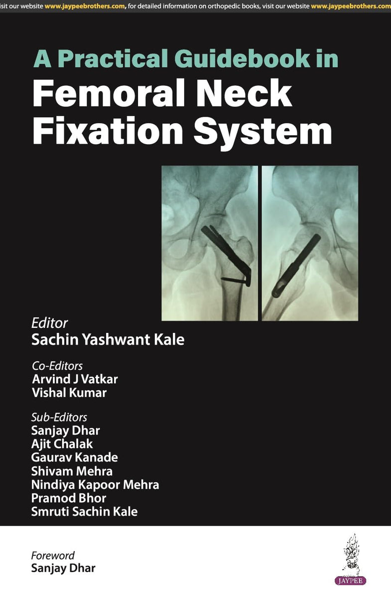 A PRACTICAL GUIDEBOOK IN FEMORAL NECK FIXATION SYSTEM