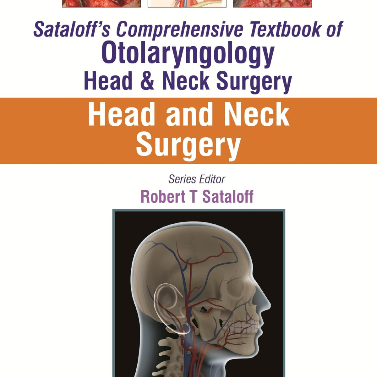 SATALOFF'S COMPREHENSIVE TB.OF OTOLARY.HEAD&NECK SURGERY HEAD AND NECK ...