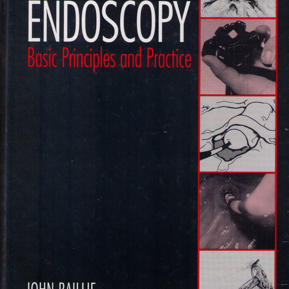 Gastrointestinal Endoscopy: Basic Principles and Practice