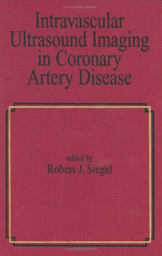 Intravascular Ultrasound Imaging in Coronary Artery Disease ...