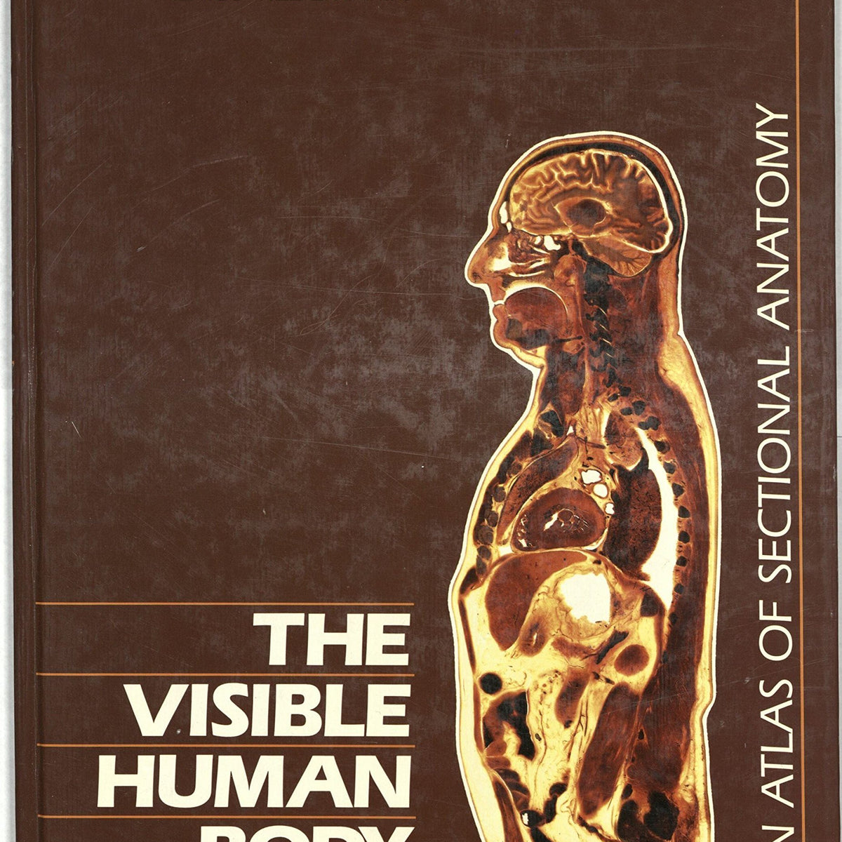 The Visible Human Body: Atlas of Sectional Anatomy
