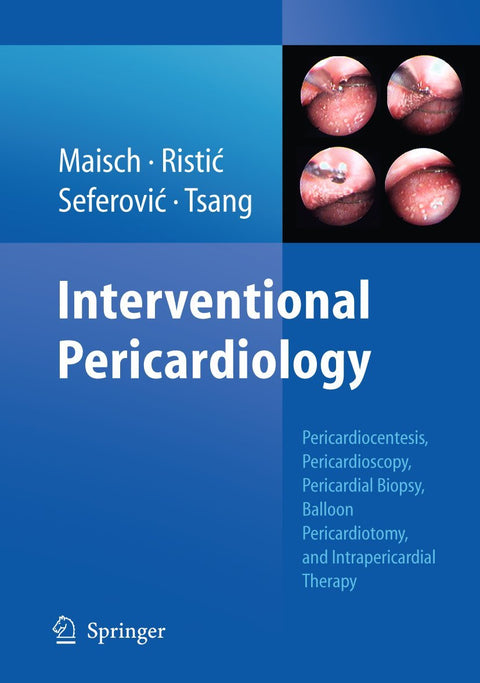 Interventional Pericardiology: Pericardiocentesis, Pericardioscopy ...